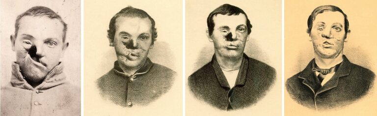 Iraq 1971 poison grain disaster leaves 459 dead - Fact Source